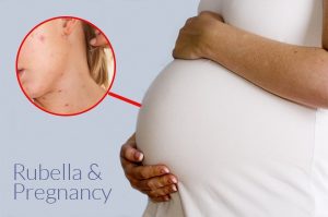 How can my rubella infection be treated? - Best IVF Specialist in Delhi ...